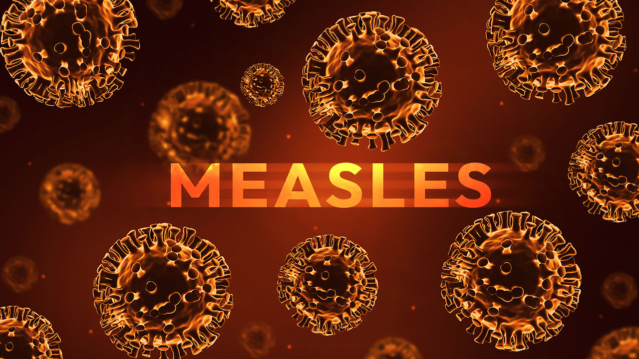 Measles Resources | Humboldt County Office of Education